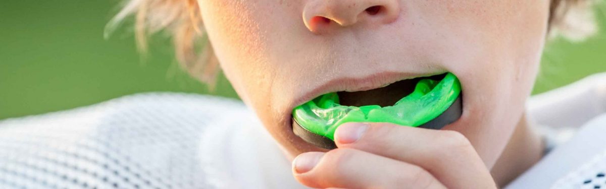 How to Choose the Right Sports Mouth Guard for Braces